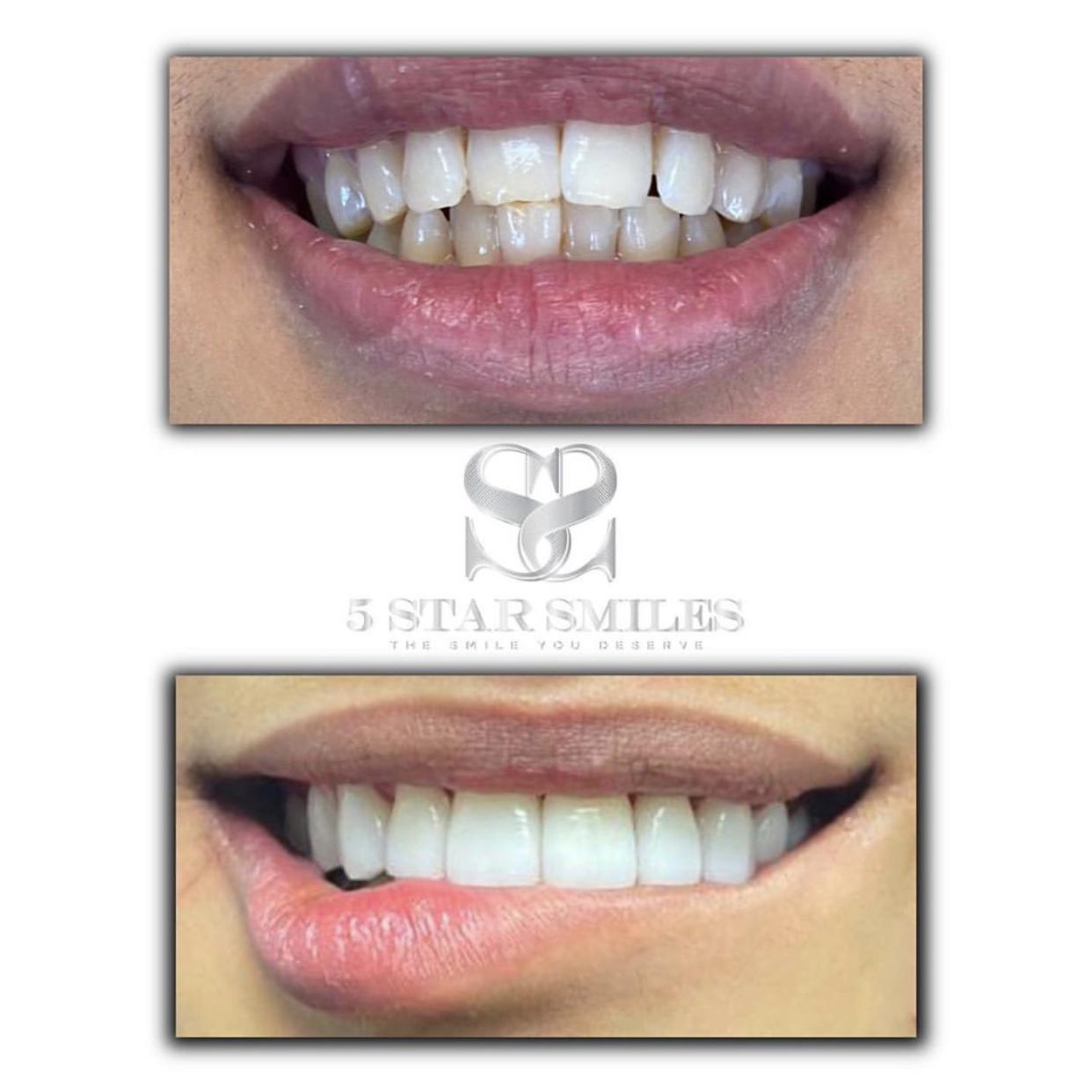 Say AHHHHHHH! Get to know 5 Star Smiles | PrettyHustlaz.com